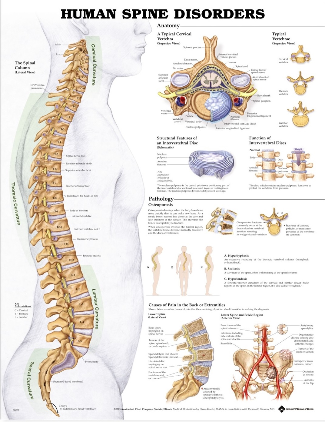 Human Spine Disorders Anatomical | Clinic Depot Inc.